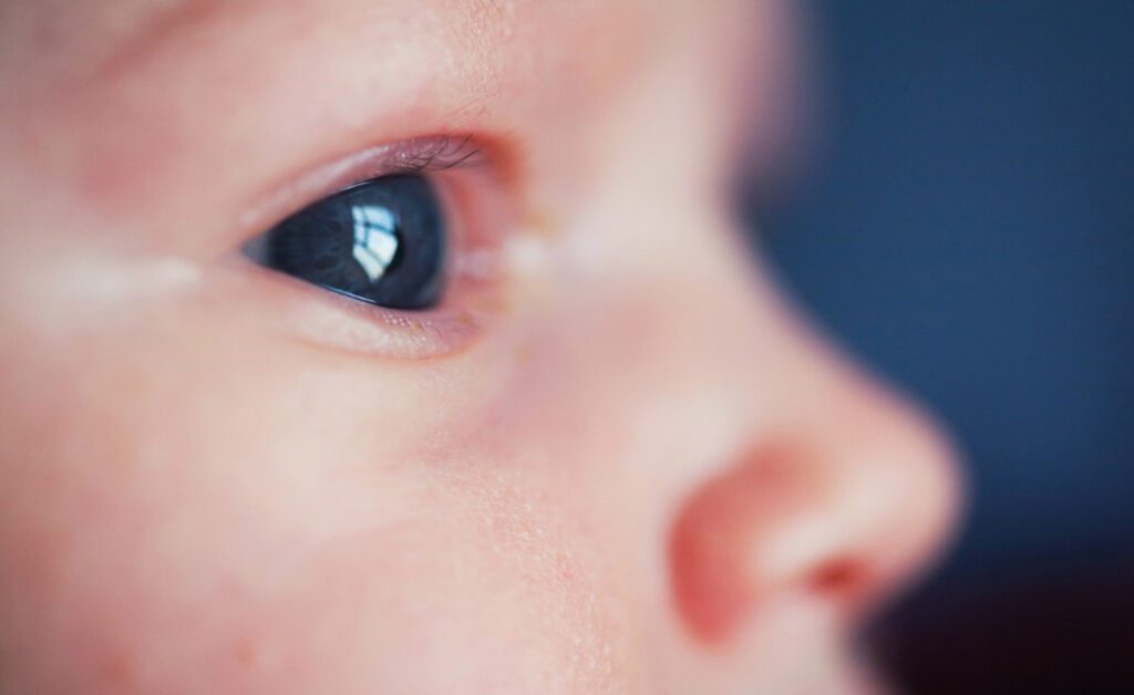 Baby Eye Discharge | Orange County Children's Eye Doctor | Dr. Golareh ...