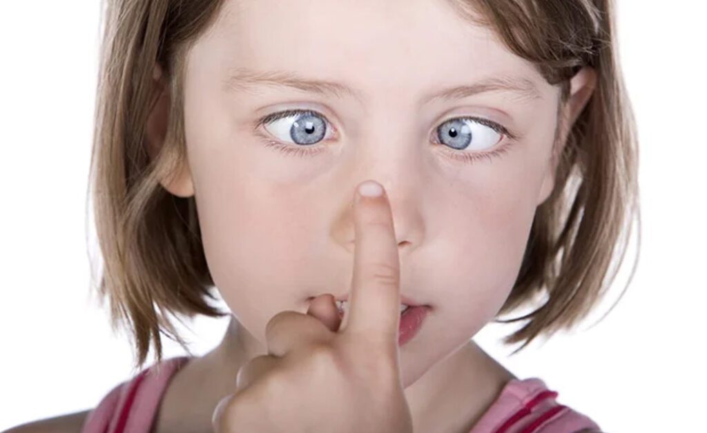 Crossed Eyes Treatment | Orange County Children's Eye Doctor | Dr ...